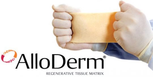 Soft Tissue Reinforcement & Regeneration Market News - iData Research