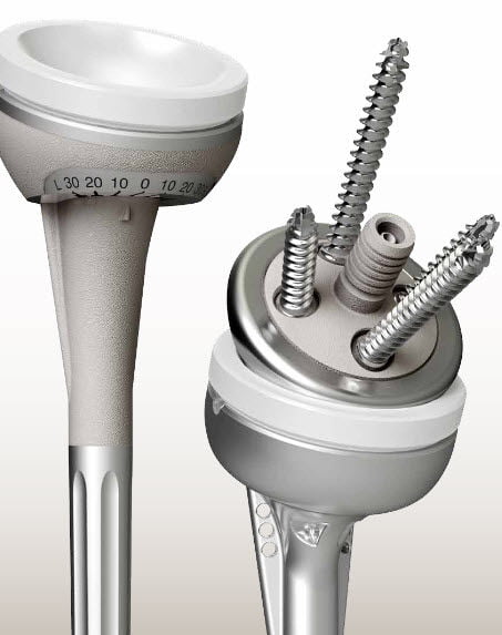 Small Joints Archives - iData Research