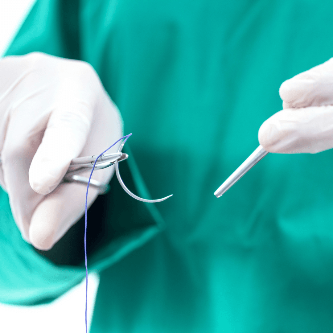 U S Wound Closure Market 3 Factors Responsible For Growth U S Wound Closure Market 3 Factors Responsible For Growth