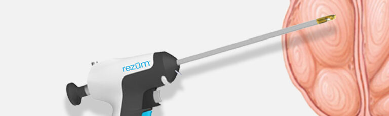 What are the Most Popular BPH Treatment Devices by Brand in the U.S ...