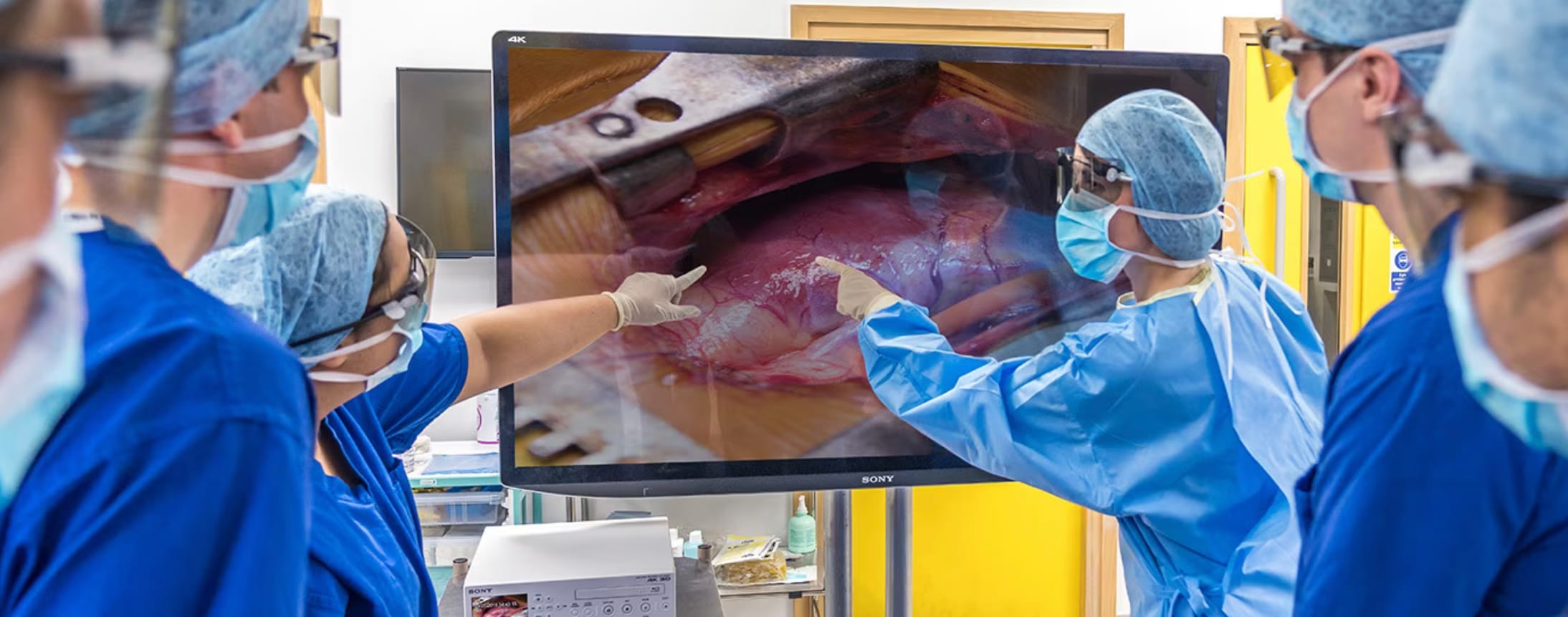 The 4K Technology Surge in the Global Video and Integrated Operating ...