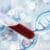 Top 5 Market Trends in In Vitro Diagnostics (2026) - iData Research